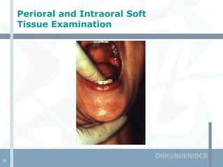 Detecting Oral Cancer - A guide for health care professionals Detecting ...