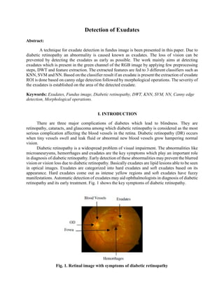 Detect Exudates in Fundus Images Using DWT | PDF