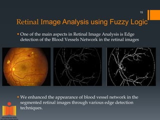 Detection of eye disorders through retinal image analysis | PPTX