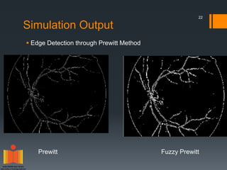 Detection of eye disorders through retinal image analysis | PPT