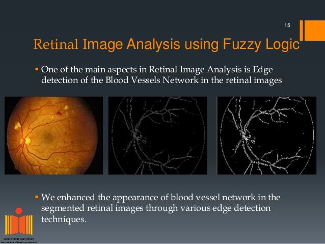 Detection Of Eye Disorders Through Retinal Image Analysis