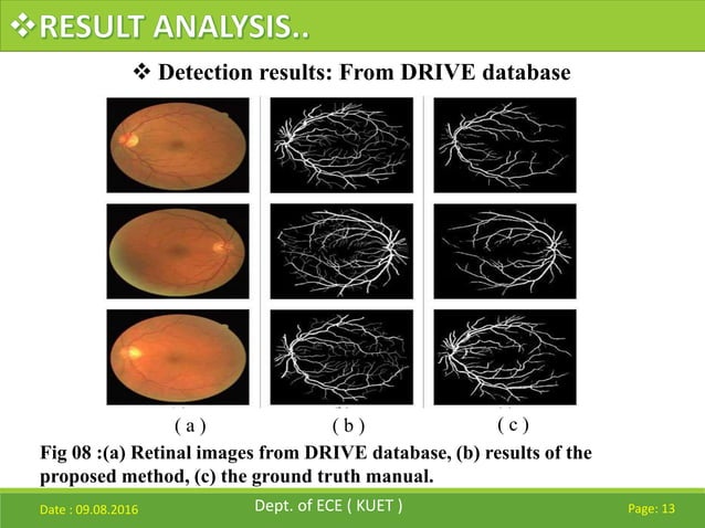 Detection of retinal blood vessel | PPTX | Eye and Vision Conditions ...