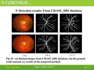 Detection of retinal blood vessel | PPTX