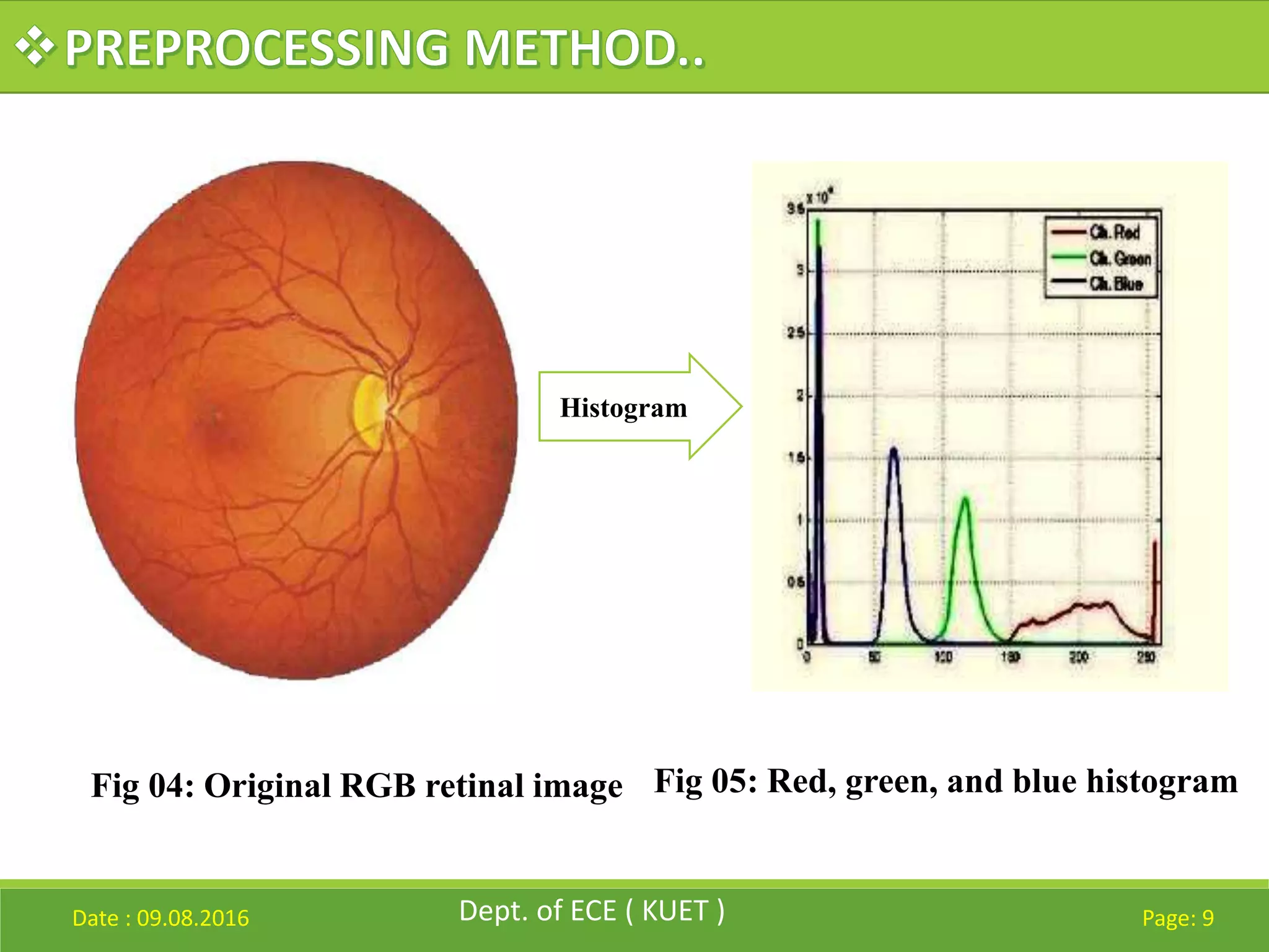 Detection of retinal blood vessel | PPT