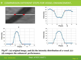 Detection of retinal blood vessel | PPT
