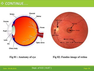 Detection of retinal blood vessel | PPT