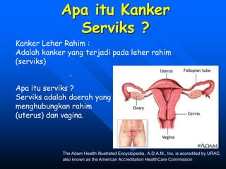 Deteksi dini-kanker-servik | PPT