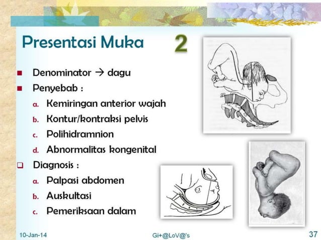 Deteksi dini dan penanganan komplikasi persalinan | PPT