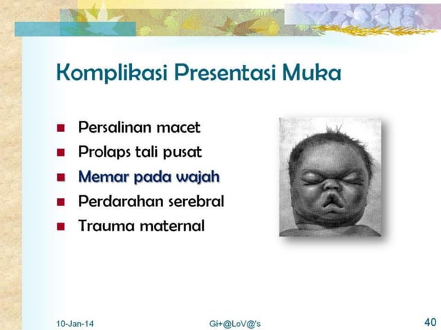 Deteksi dini dan penanganan komplikasi persalinan | PPT