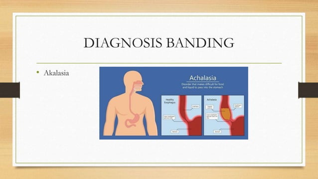 deteksi dini kanker esofagus.pptx