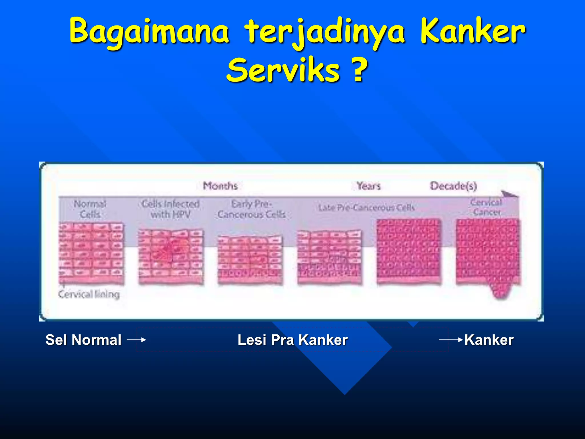 Kanker Serviks | PPT