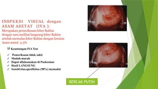 DETEKSI DINI KANKER leher rahim. dengan IVA.pptx