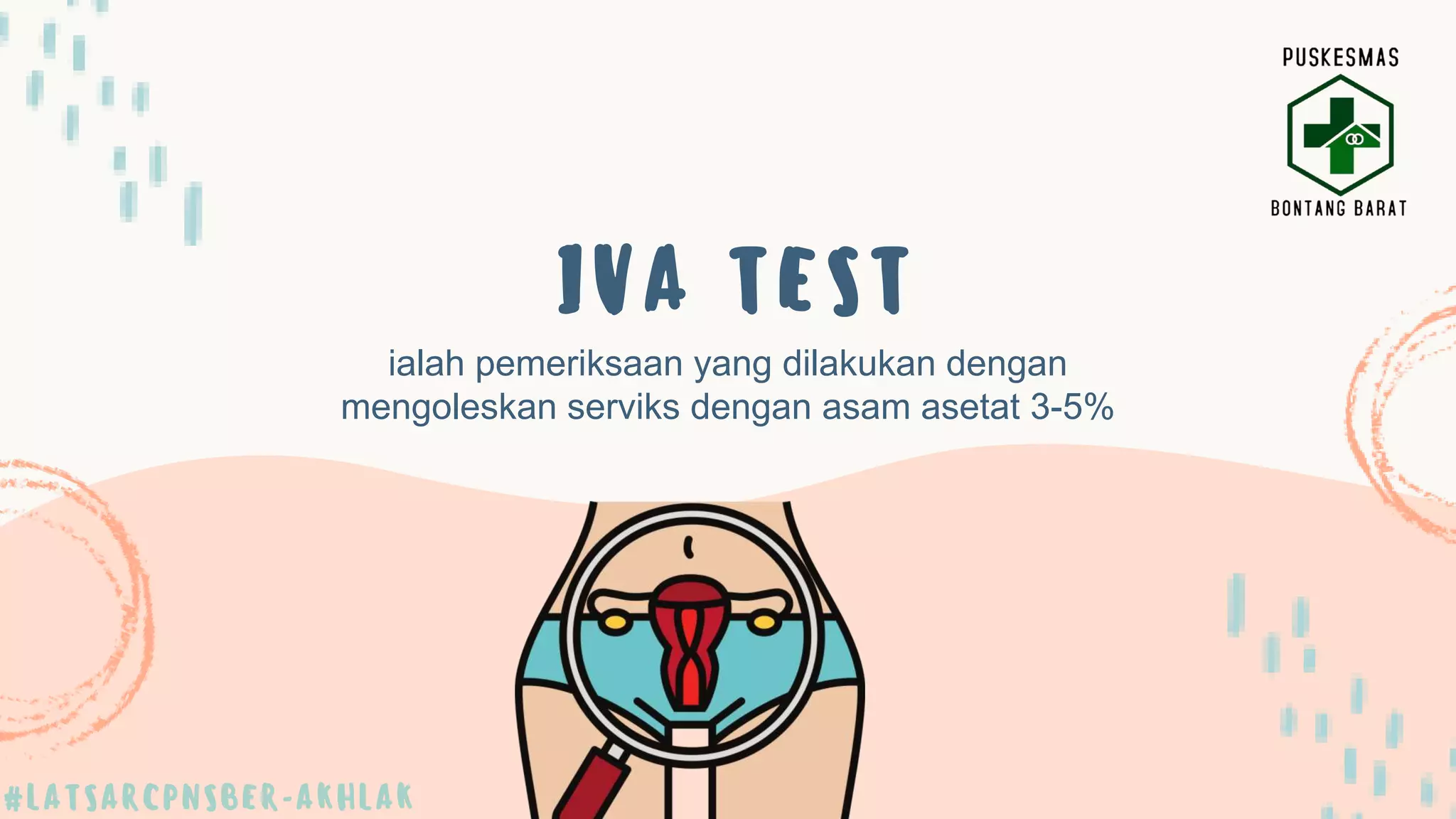 Deteksi dini Kanker serviks sebelum terlambat.pptx