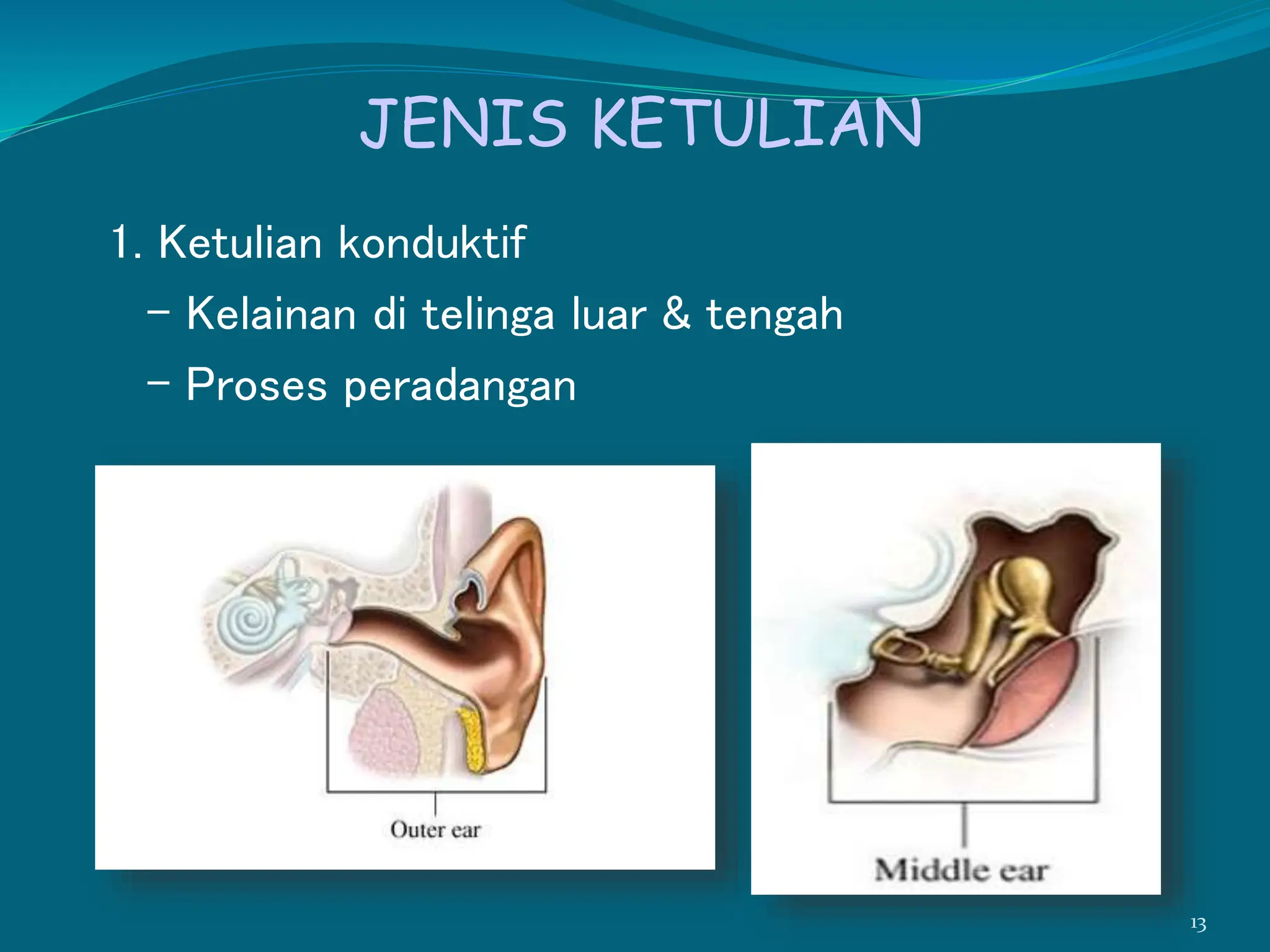 deteksi ganguan pendengaran.pptx