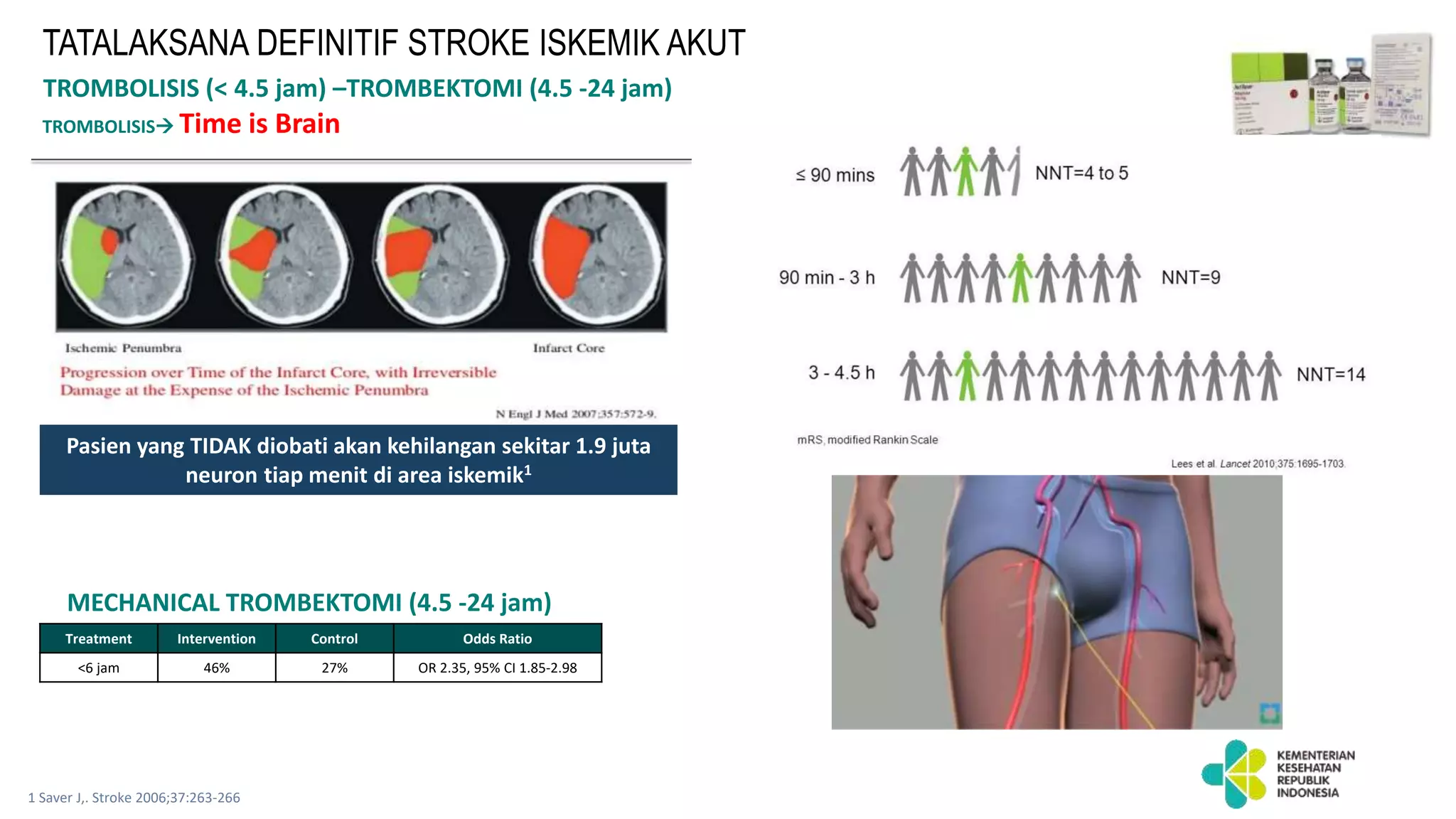Deteksi Pre-Hospital Stroke .pptx