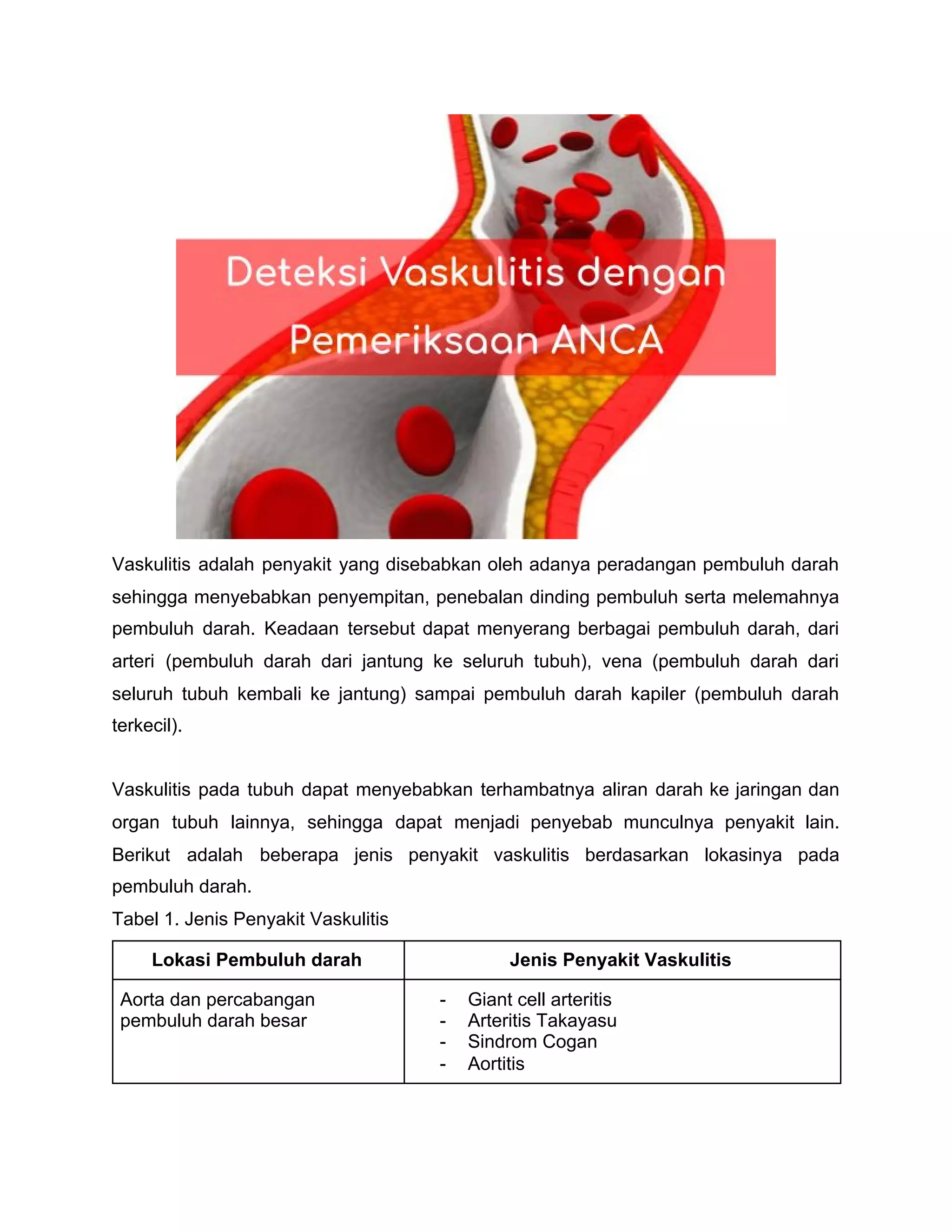 Deteksi vaskulitis dengan pemeriksaan anca | PDF