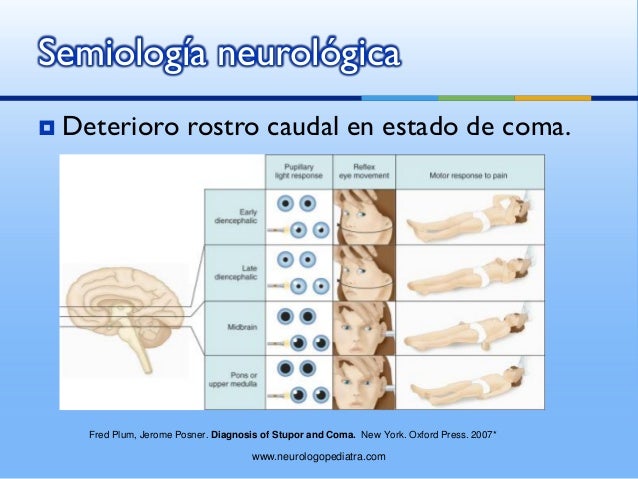Deterioro agudo del estado de conciencia2