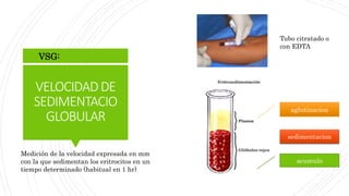 Determinacion de vsg | PPT