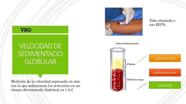 Determinacion de vsg
