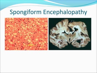 Determinants of-survival-time-in-human-prion-diseases-1233685082975925 ...