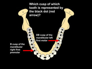 Determinants of occlusion | PPT