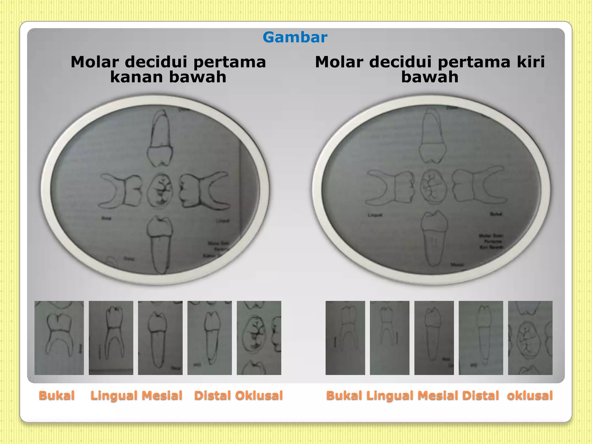 Determinasi gigi molar decidui bawah syiiiik | PPTX