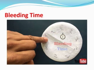 DETERMINATION OF BLEEDING AND CLOTTING TIME Ass.Lec Hussein Hamid Al ...