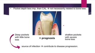 DETERMINATION OF PROGNOSIS IN PERIODONTICS.pptx