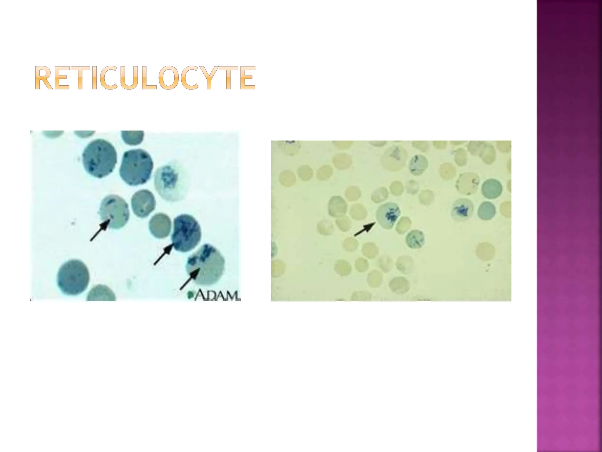 Determination of Reticulocyte Count - Copy.pptx