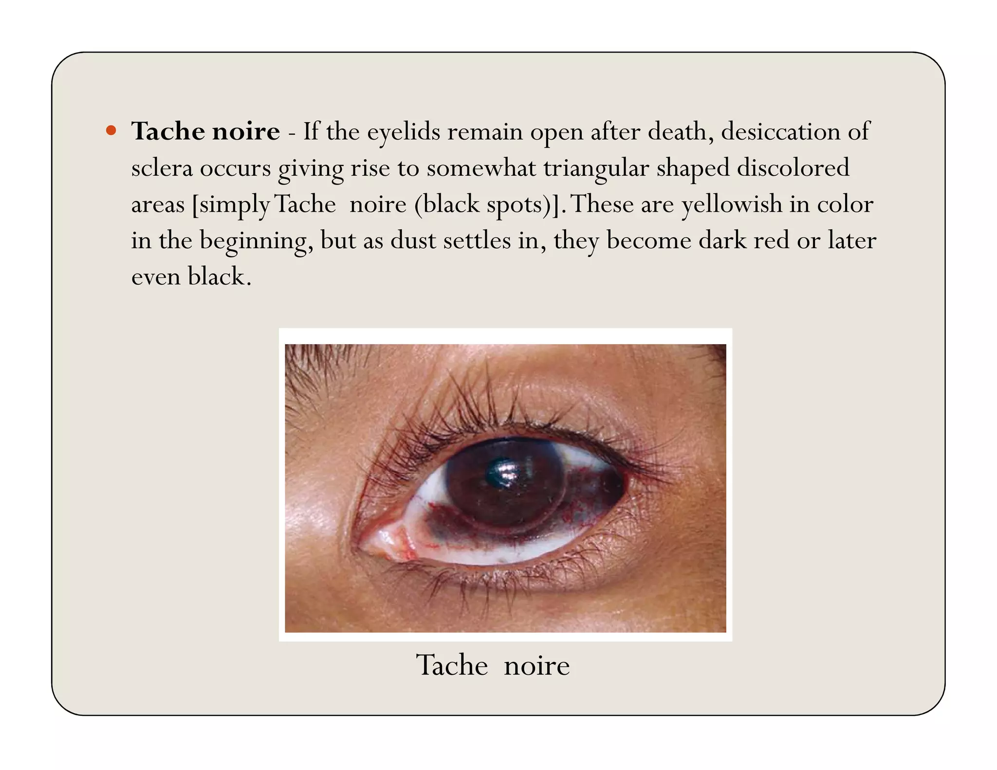 Determination of time since death/ postmortem time interval | PDF