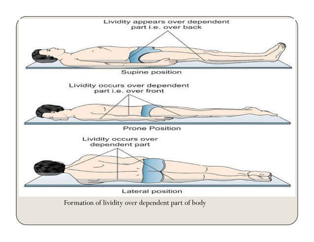 Determination of time since death/ postmortem time interval | PDF | Eye ...