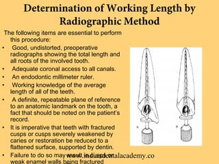 Determination of root canal working length /certified fixed orthodontic ...