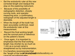 Determination of root canal working length /certified fixed orthodontic ...
