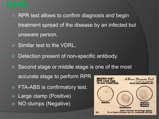 Laboratory Determination of syphilis | PPTX