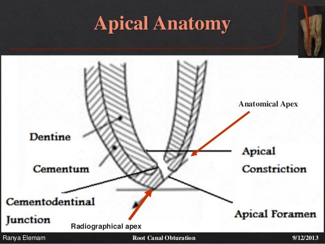 Determining the optimal obturation length