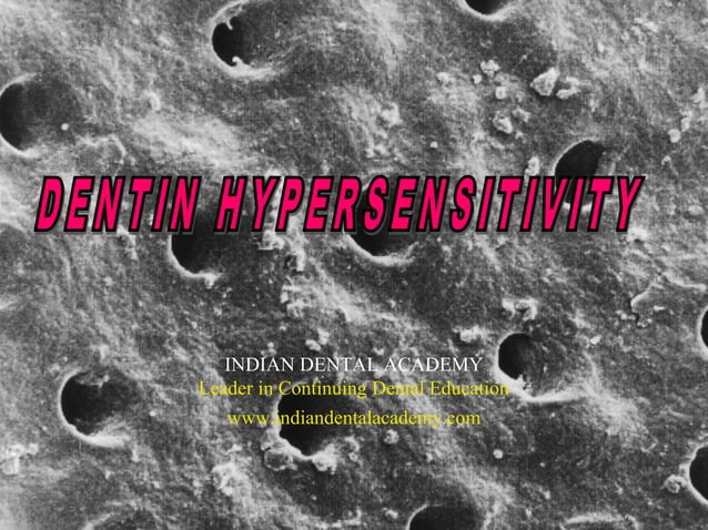Dentinal hyper sensitivity / /certified fixed orthodontic courses by Indian dental academy | PPT