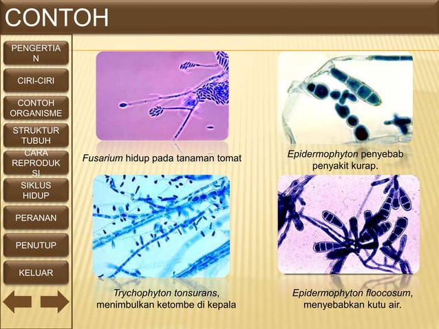 Deuteromycota | PPTX
