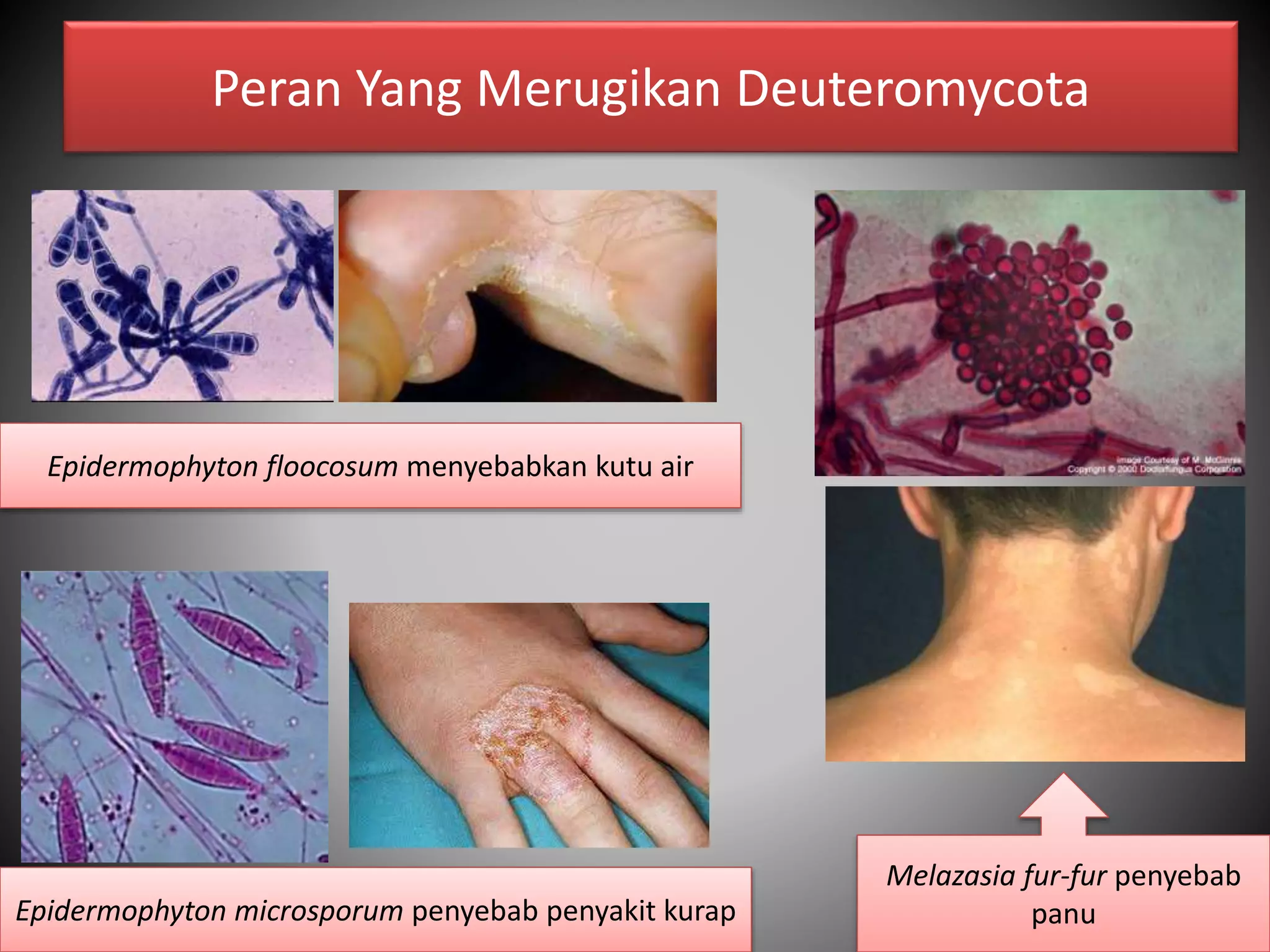 Materi Biologi Deuteromycota SMA | PPTX