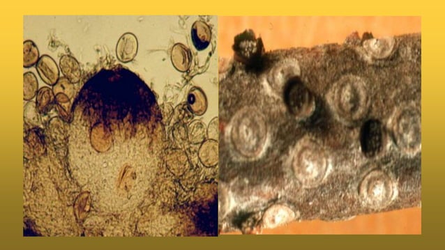 Deuteromycotina | PPTX