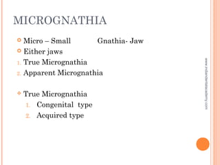 DEVELOPMENTAL DISTURBANCES OF JAWS & DENTAL ARCH / oral surgery courses ...