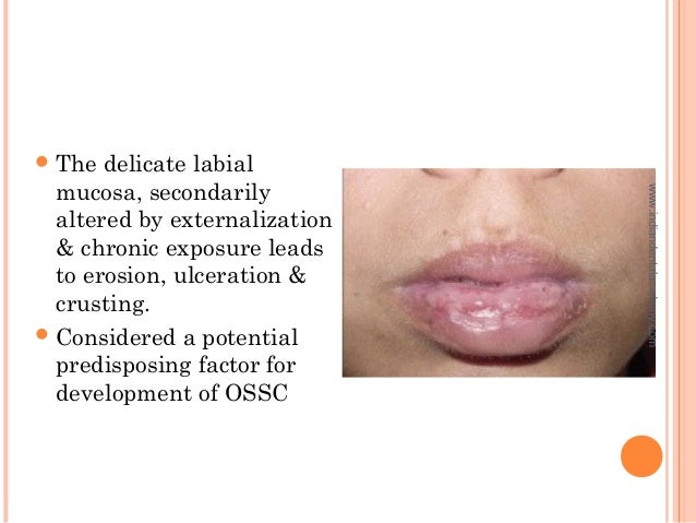 DEVELOPMENTAL DISTURBANCES OF LIPS & PALATE / dental implant courses