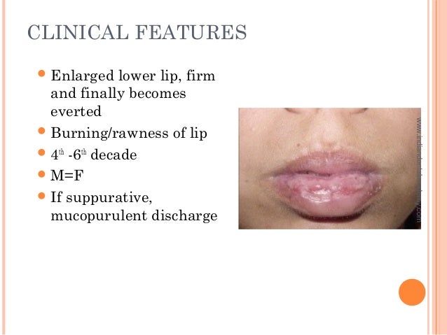 DEVELOPMENTAL DISTURBANCES OF LIPS & PALATE / dental implant courses