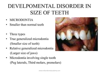 Developmental Disturbances of Oral & Paraoral structures-3 ...