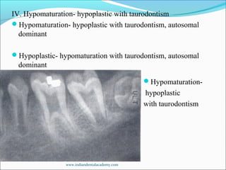 Developmental disturbances in structure of teeth Amelogenesis ...