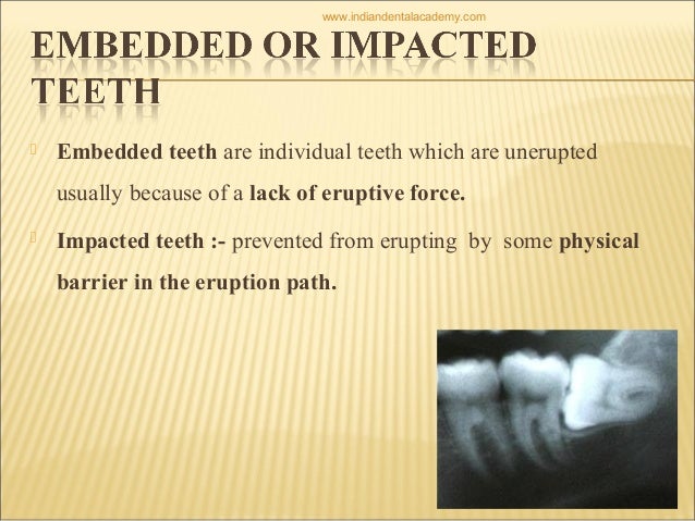 Disturbances of growth of (Eruption) of teeth