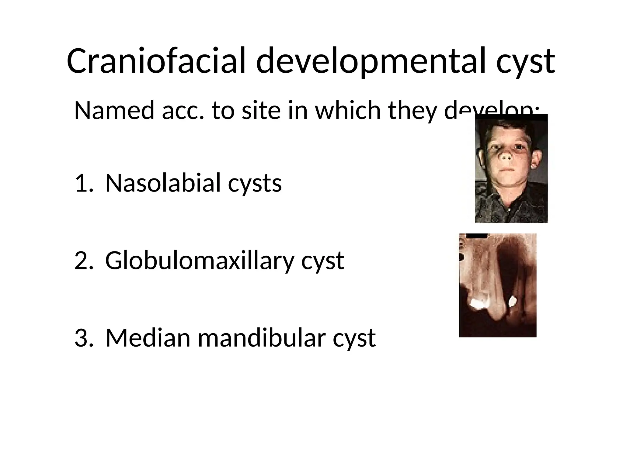 DEVELOPMENT of face n Craniofacial system AND ABNORMALITIES OF ...