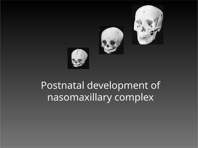 DEVELOPMENT of face n Craniofacial system AND ABNORMALITIES OF ...