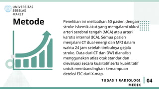 Non-contrast dual-energy CT using X-map for acute ischemic stroke: region-specific comparison ...