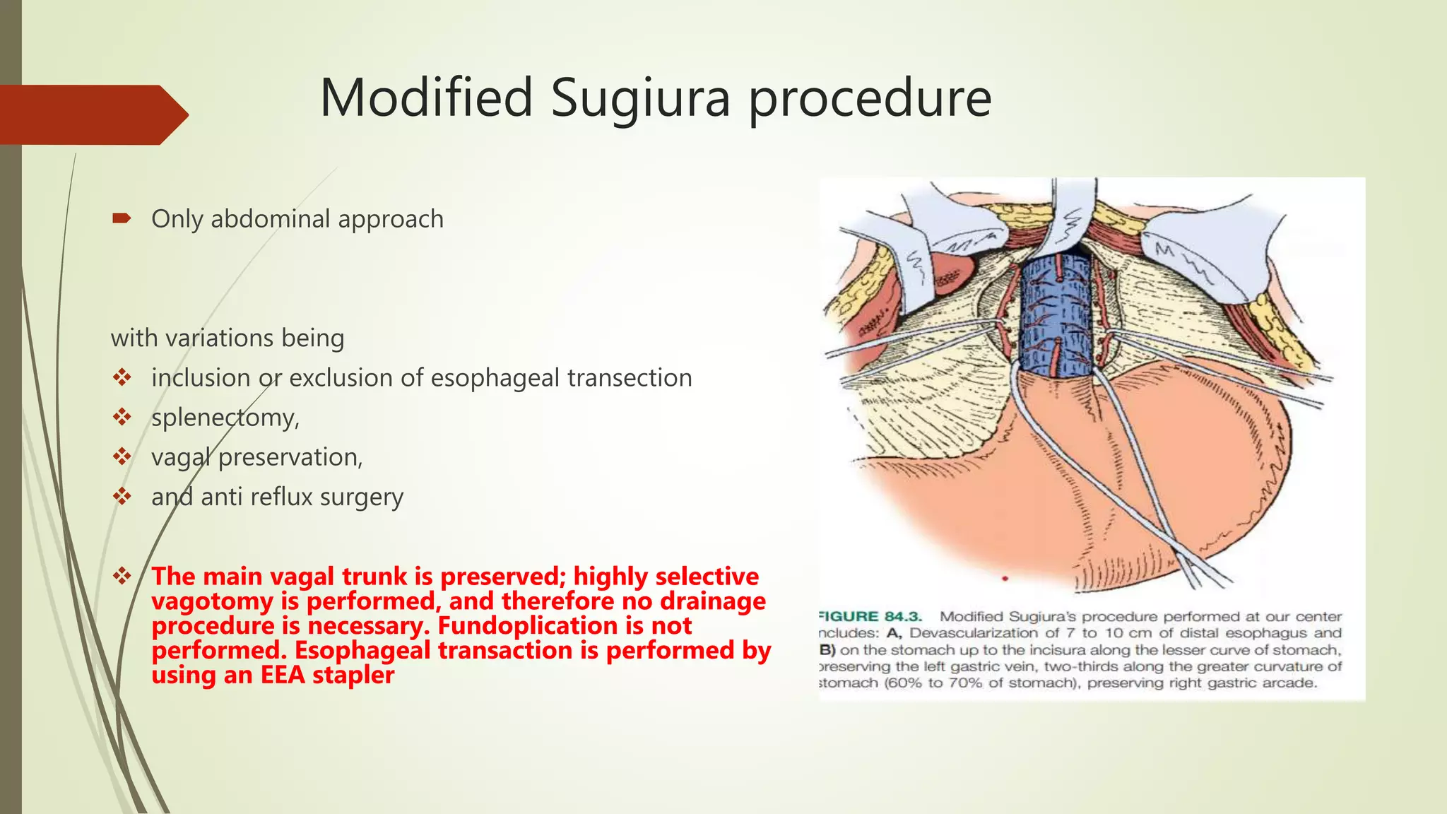 Devascularization in portal hypertension.dr quiyum | PPTX