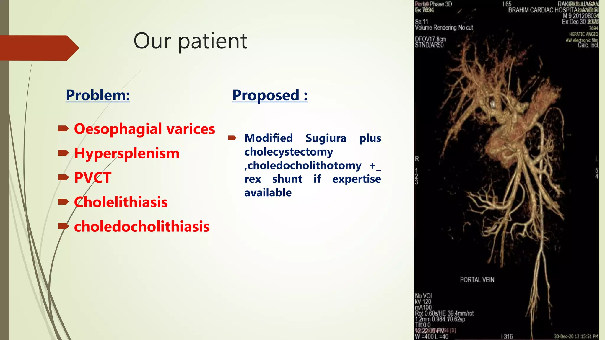 Devascularization in portal hypertension.dr quiyum | PPTX
